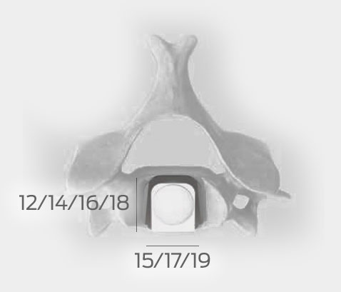 Centinel Spine | For prodisc® Motion-Preservation/Disc Arthroplasty and ...