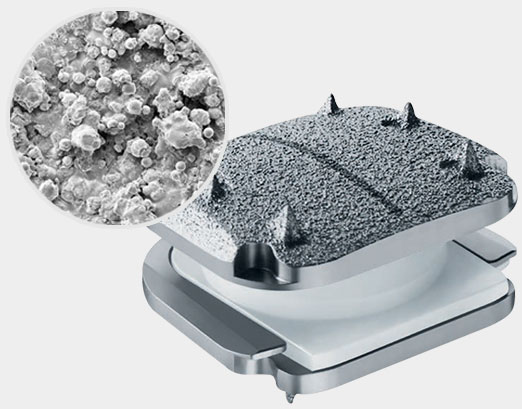 Centinel Spine | For prodisc® Motion-Preservation/Disc Arthroplasty and ...